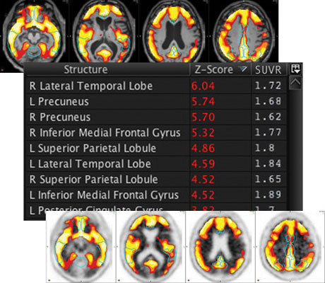 MIM Software - Beijing - Press Release - MIMneuro 5.5